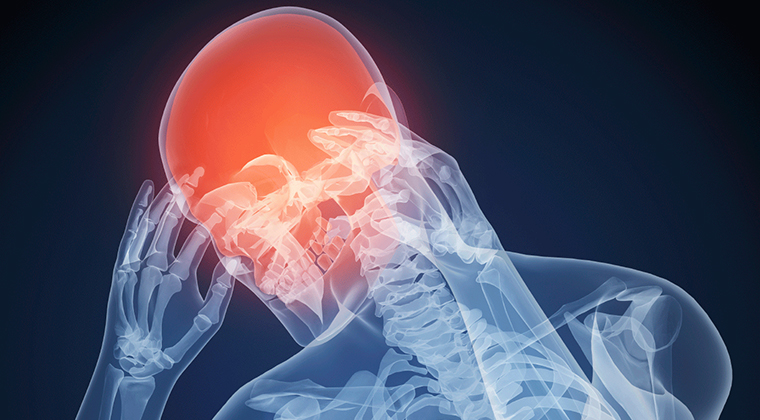 Are your Headaches Normal? - Wellbeing Magazine